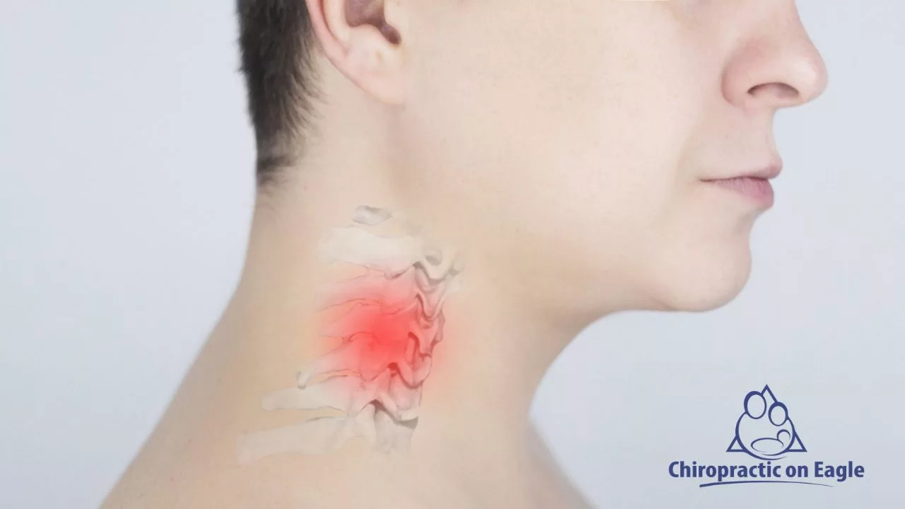 Cervical Disc Bulge Treatment | Newmarket Chiropractor - Chiropractic ...